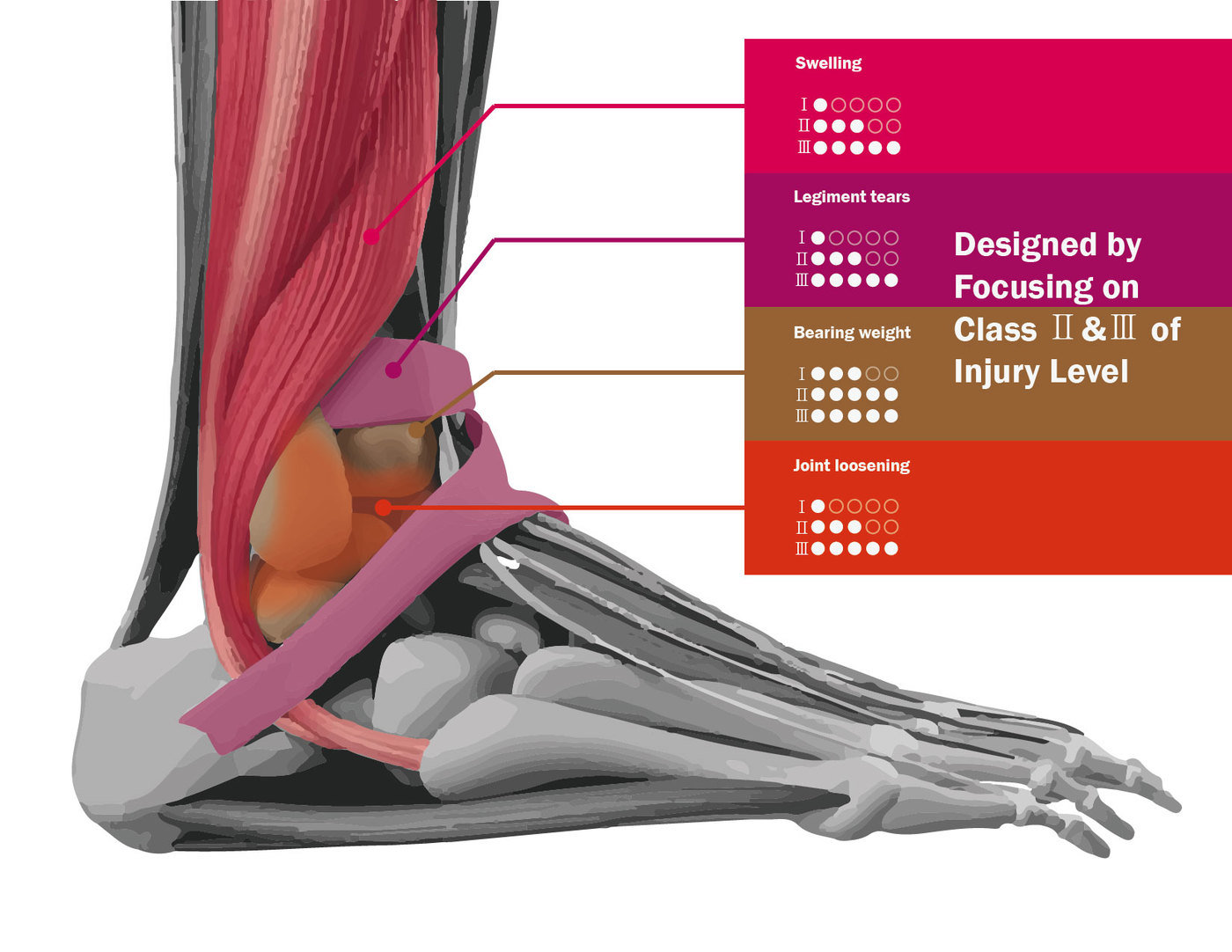 ANGO-recovery boot for ankle injury - 普象网