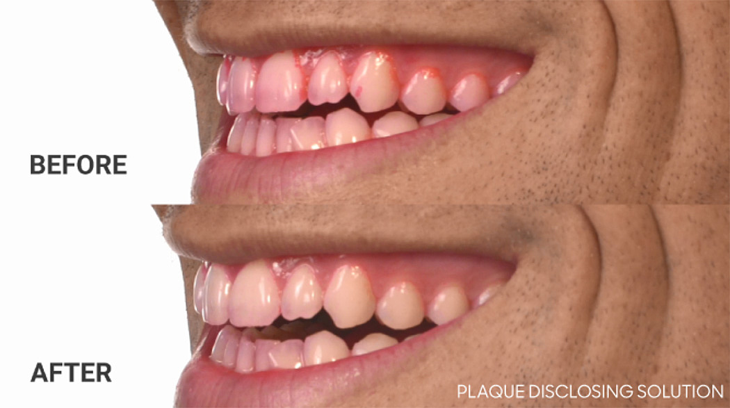 This innovative self-brushing toothbrush flawlessly cleans your teeth ...