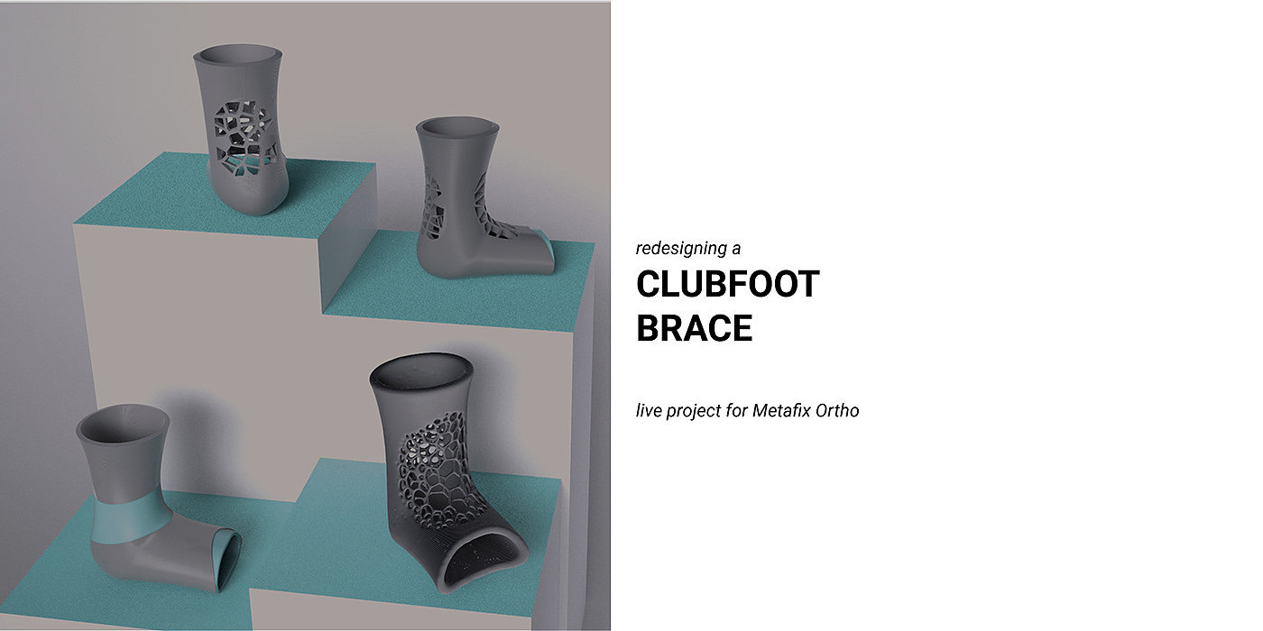 Metafix Clubfoot Brace - 普象网