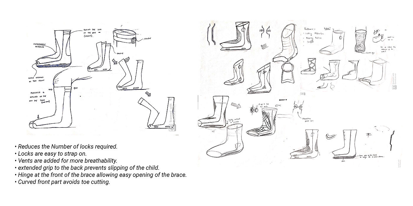 Metafix Clubfoot Brace - 普象网