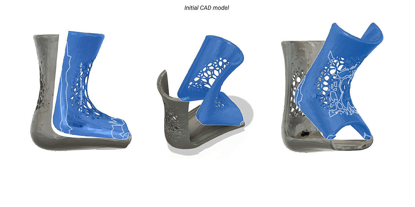 Metafix Clubfoot Brace - 普象网