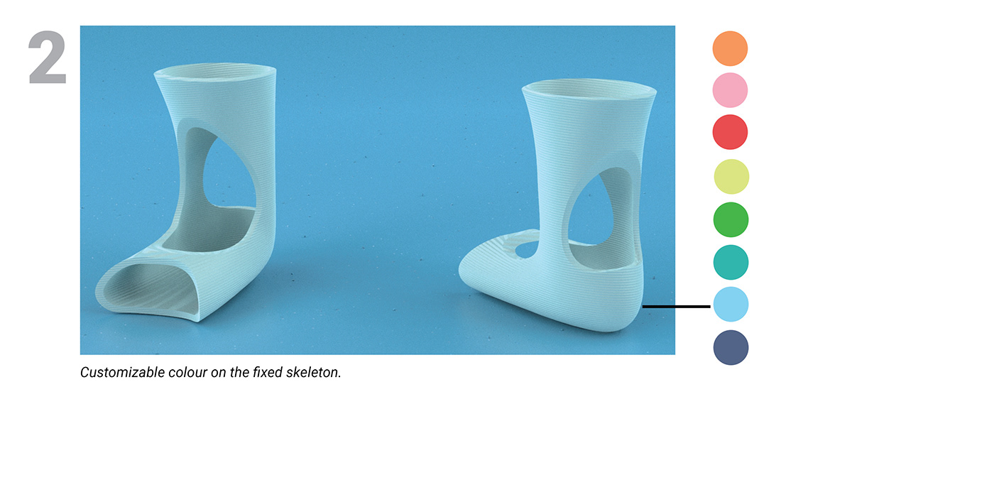 Metafix Clubfoot Brace - 普象网