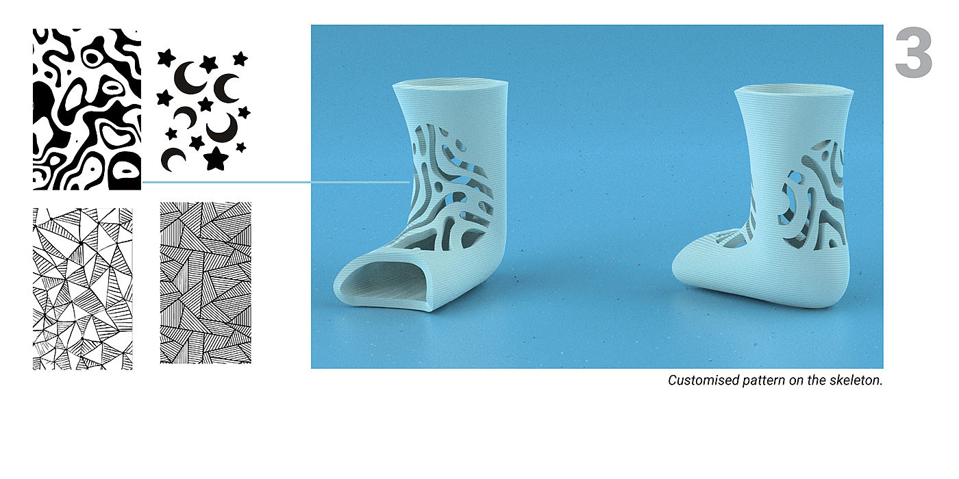 Metafix Clubfoot Brace - 普象网