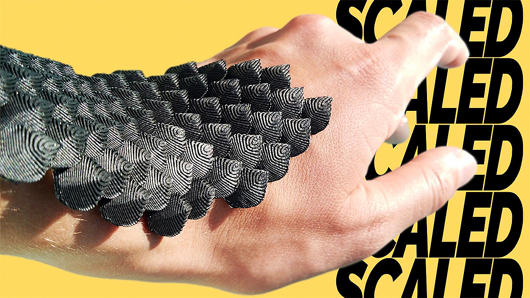 This wearable cast revolutionizes healthcare by protecting and healing ...