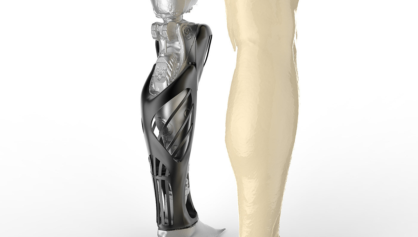 Customized 3D Printed prosthetic leg cover 2 - 普象网