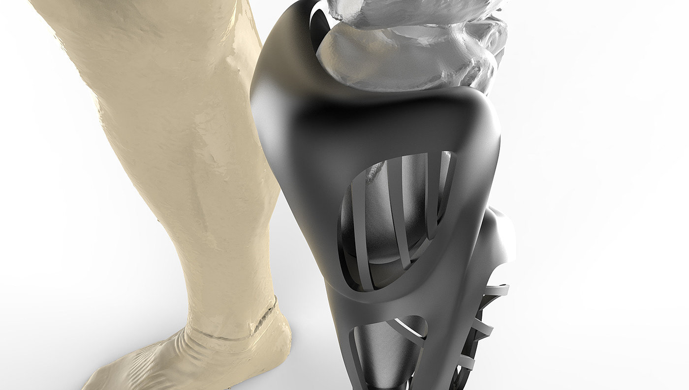 Customized 3D Printed prosthetic leg cover 2 - 普象网