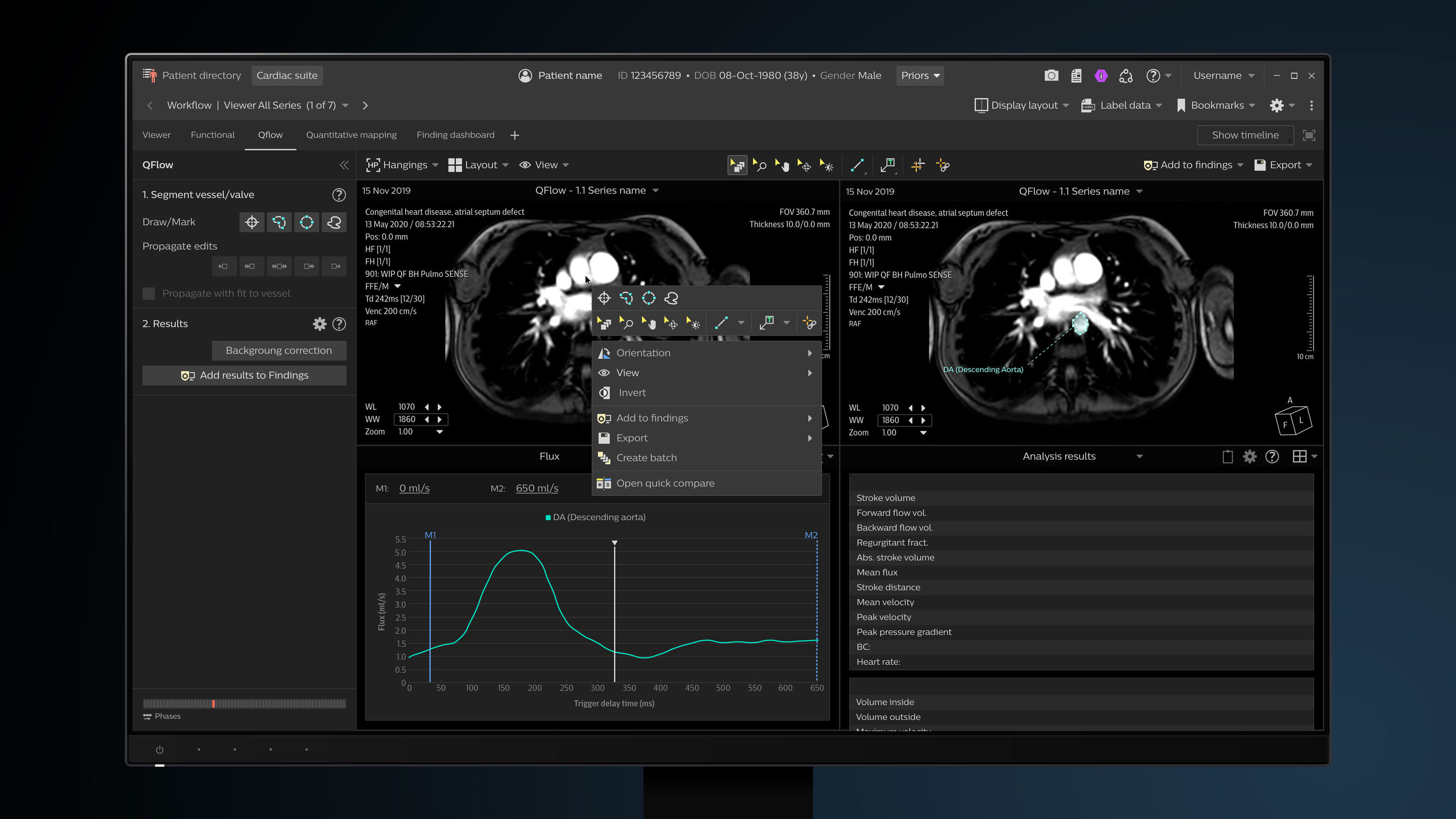 【2022年 iF设计奖】Philips IntelliSpace Portal Cardiac MR Suite - 普象网