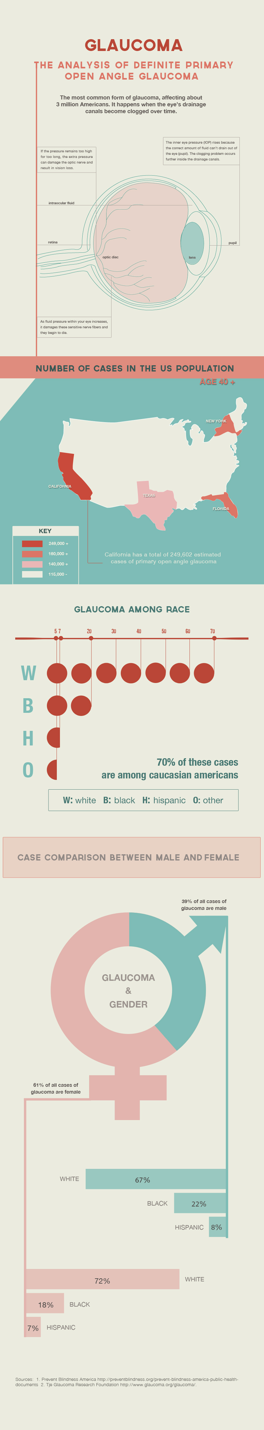 Infographic: Glaucoma - 普象网