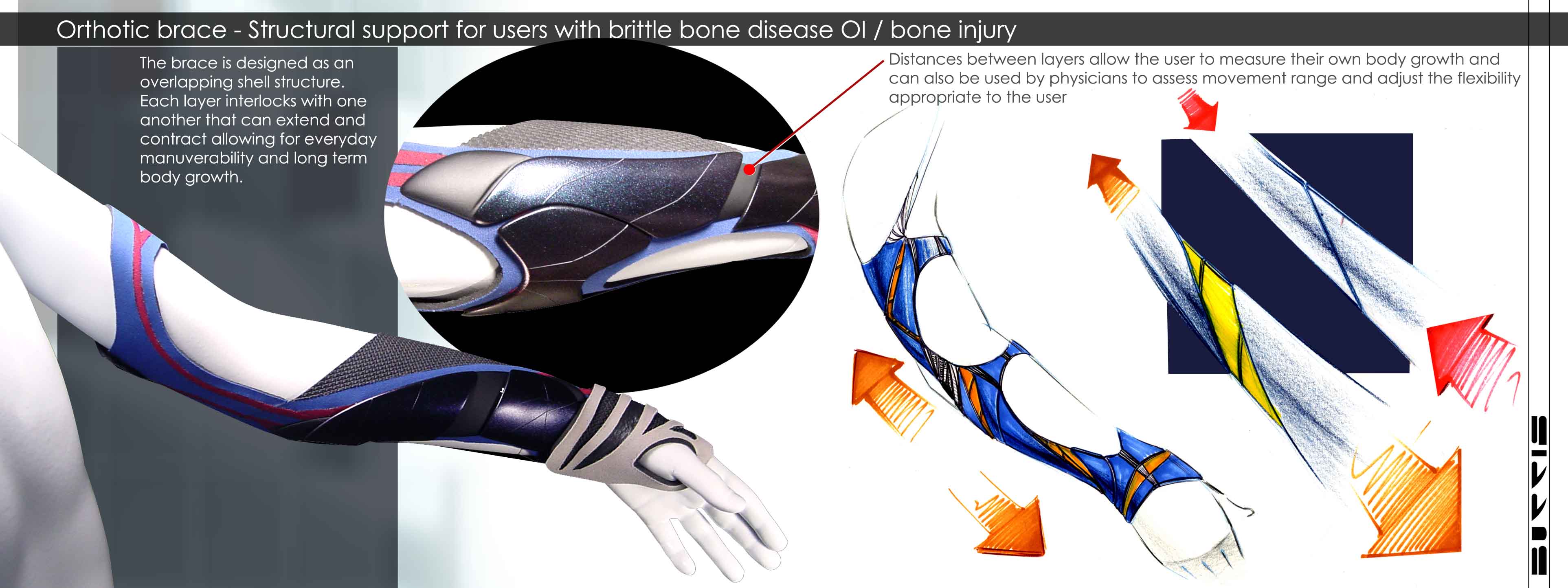 Modular Orthotic Brace - 普象网