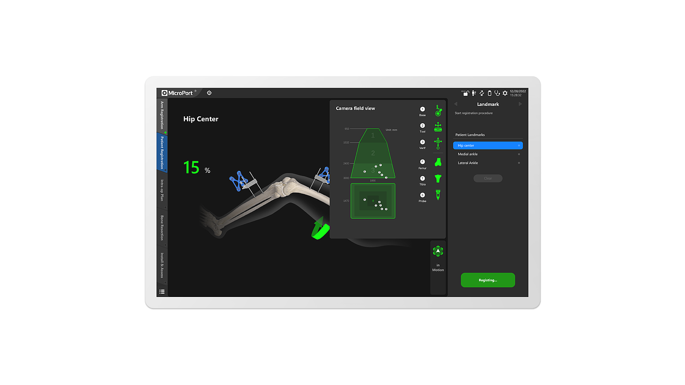 【2023年 iF设计奖】Honghu Robotic Orthopedic Surgical System - 普象网
