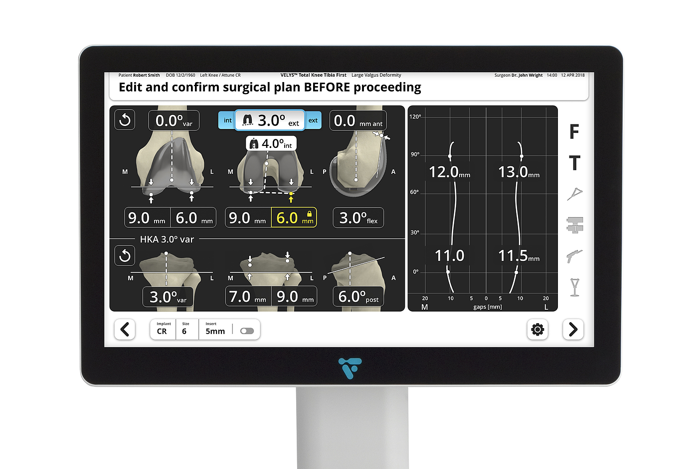 【2023年 iF金质奖】VELYS Robotic-Assisted Solution - 普象网